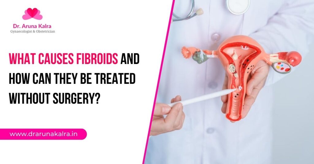 Fibroids: Causes and Non-Surgical Treatments